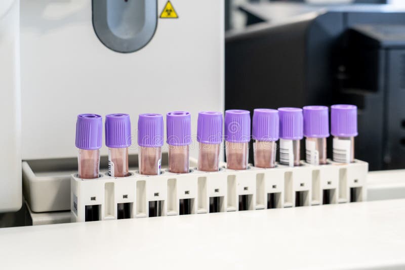 Laboratory Doing Tests for Vaccine Blood Extraction and Analytical ...