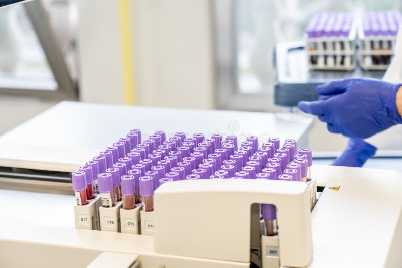 Woman in Laboratory Doing Tests for Vaccine Blood Extraction and ...