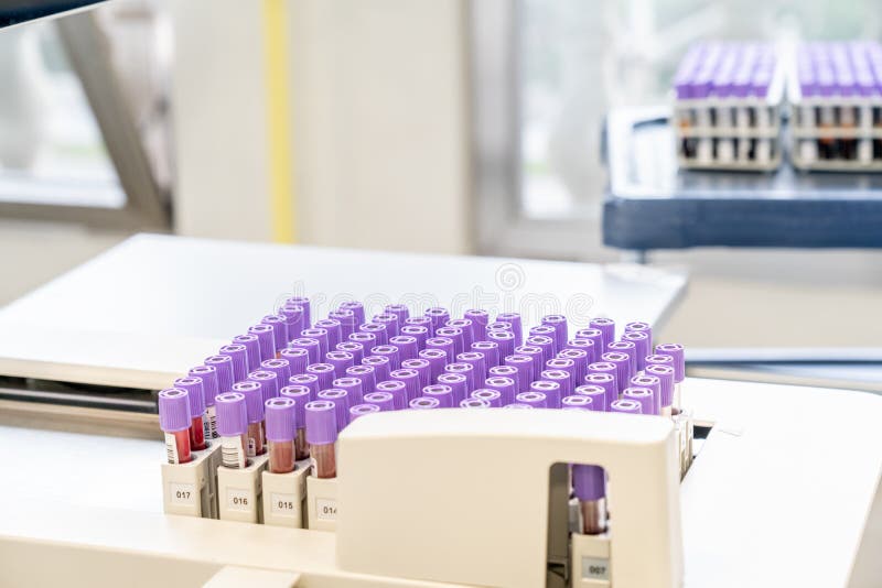 Laboratory Doing Tests for Vaccine Blood Extraction and Analytical ...