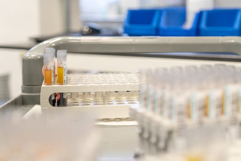 Laboratory Doing Tests for Vaccine Blood Extraction and Analytical ...