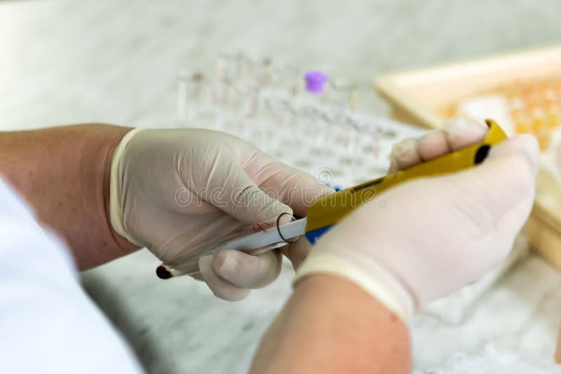 Laboratory Equipment for Blood Analysis. the Real Work of the ...