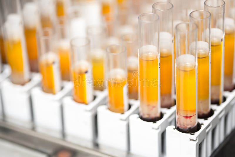 Laboratory Glass Test Tubes Filled with Orange Liquid for an Experiment ...
