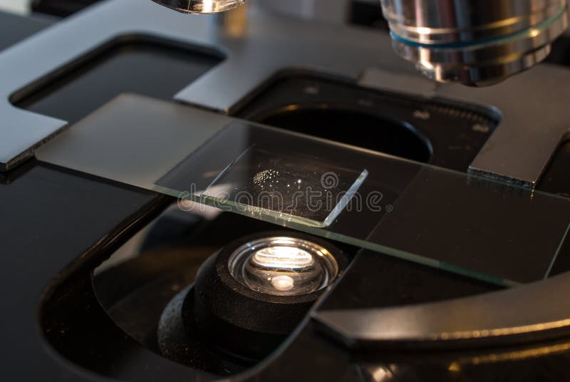 Laboratory Medicine - Microscopic Urine Test Stock Image - Image of ...