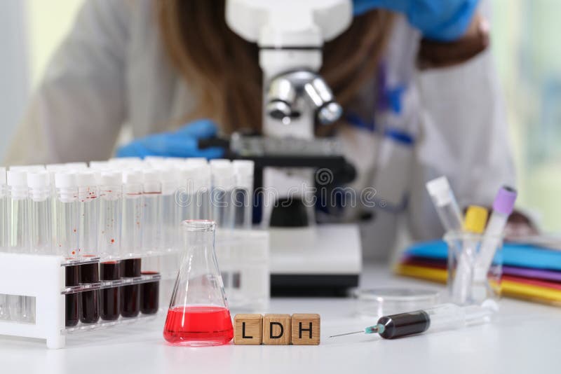 A Laboratory Microscope with Test Tubes and LDH Measurement for ...