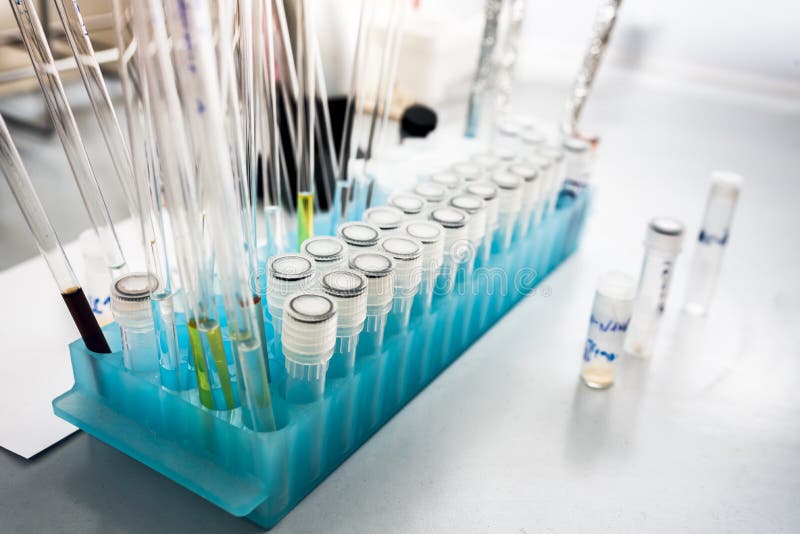 Laboratory Plastic Tubes and Gloves. Laboratory Research. Medical Tests ...