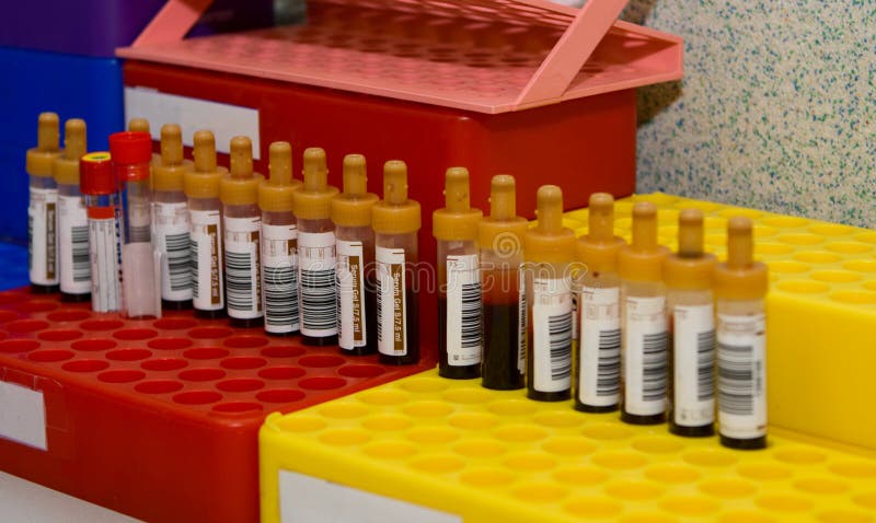 Laboratory sample tubes stock image. Image of plastic - 6555145