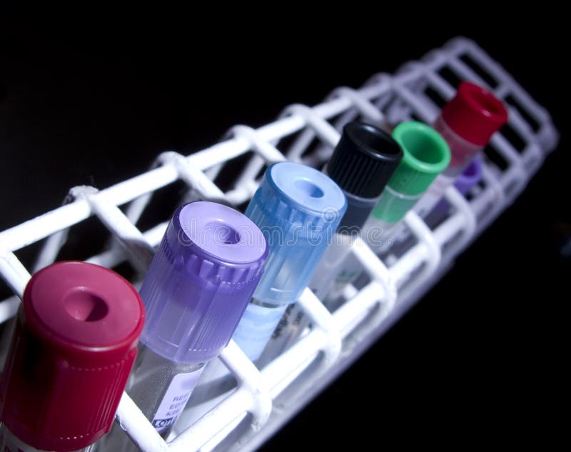 Laboratory samples stock image. Image of diagonal, care - 3877889