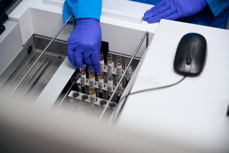 Laboratory Set with Test Tubes with Biomaterial for General Urine ...