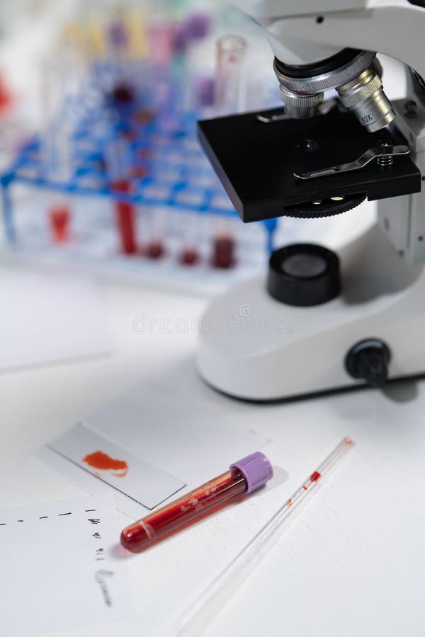 Microscope with Test Tubes on a Laboratory Bench Stock Photo - Image of ...