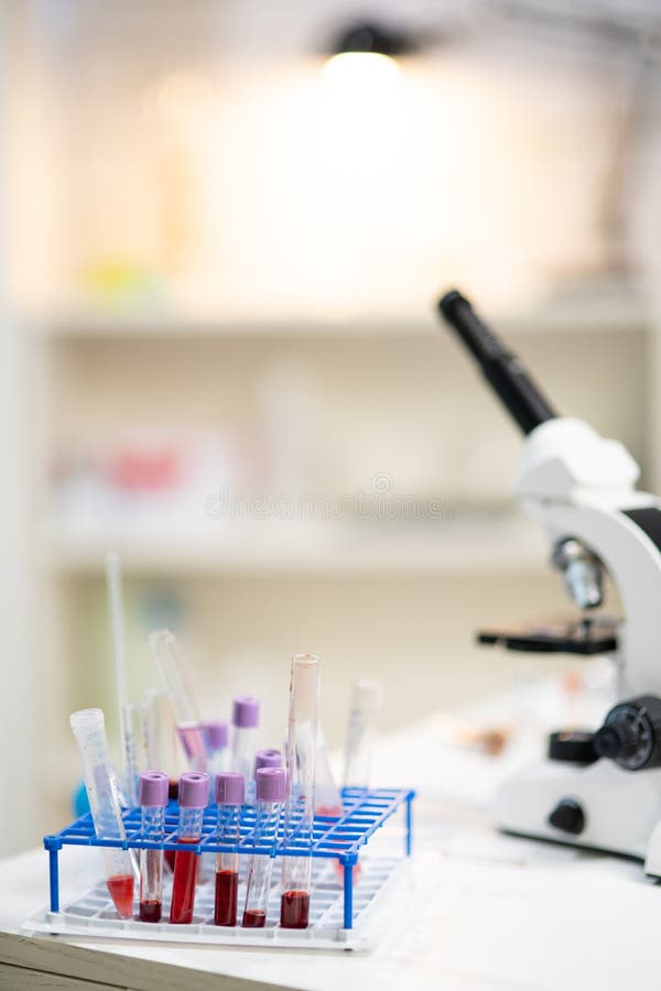 Microscope with Test Tubes on a Laboratory Bench Stock Image - Image of ...