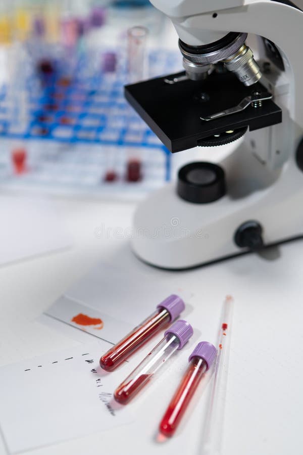 Microscope with Test Tubes on a Laboratory Bench Stock Photo - Image of ...