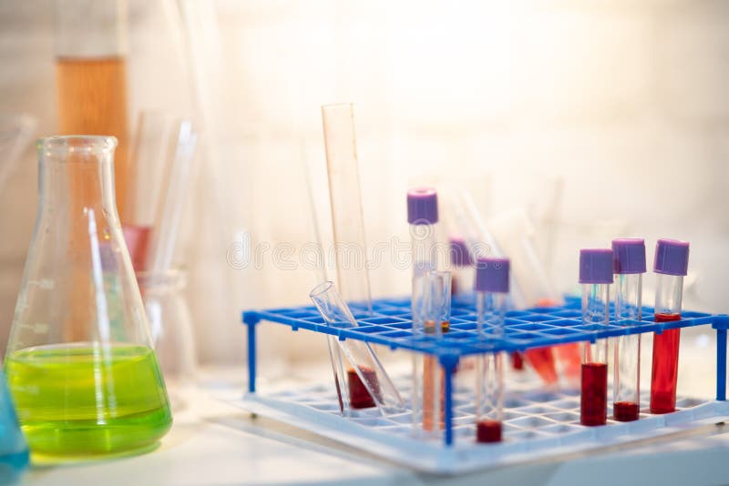 Microscope with Test Tubes on a Laboratory Bench Stock Photo - Image of ...