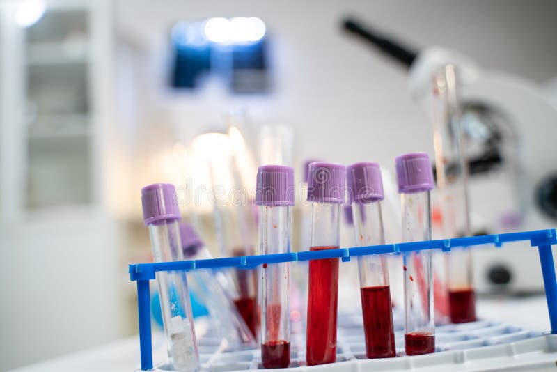 A laboratory table stock photo. Image of chemist, science - 177322352