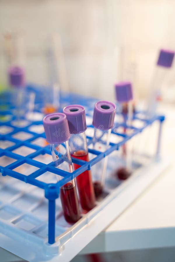 A laboratory table stock image. Image of pharmaceutical - 177322769