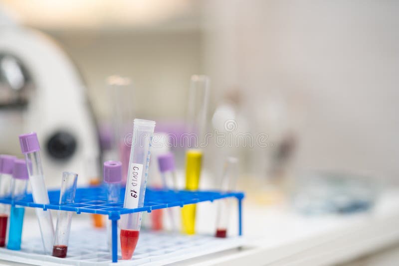 A laboratory table stock image. Image of analysis, beaker - 177323197