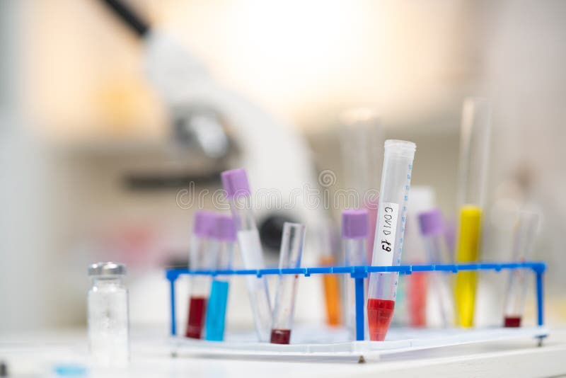 A laboratory table stock photo. Image of scientific - 177323386