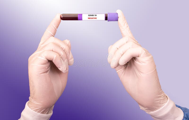 Laboratory Technician Hold on Blood Sample Tube Tested Negative for ...
