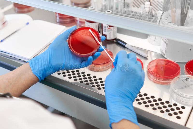 Laboratory Technician Testing Samples of Cell Cultivation in a Hospital ...