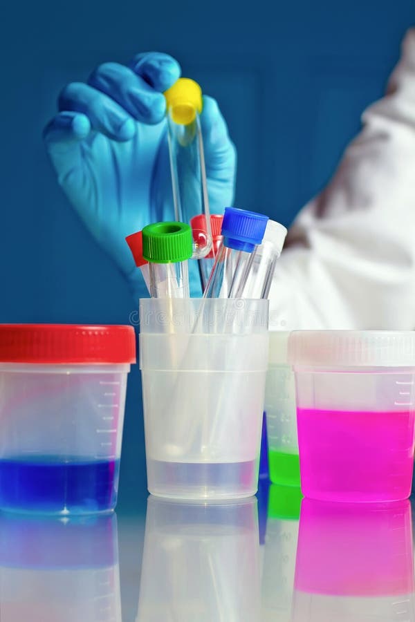 Laboratory test tubes stock photo. Image of hospital - 22595094