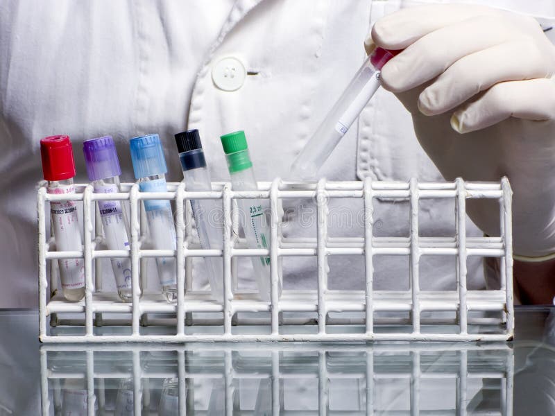 Laboratory test tubes stock image. Image of gloves, chemistry - 3872397