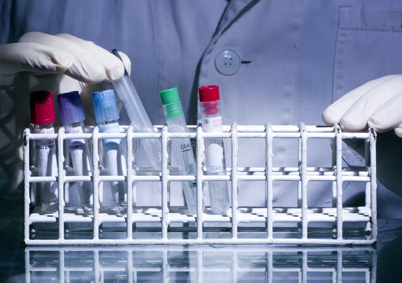 Laboratory Test Tubes Abstract Stock Photo - Image of blurred, medical ...