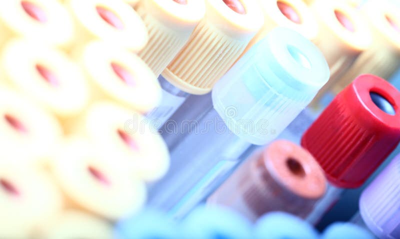 Laboratory test tubes stock image. Image of cell, exam - 37408475