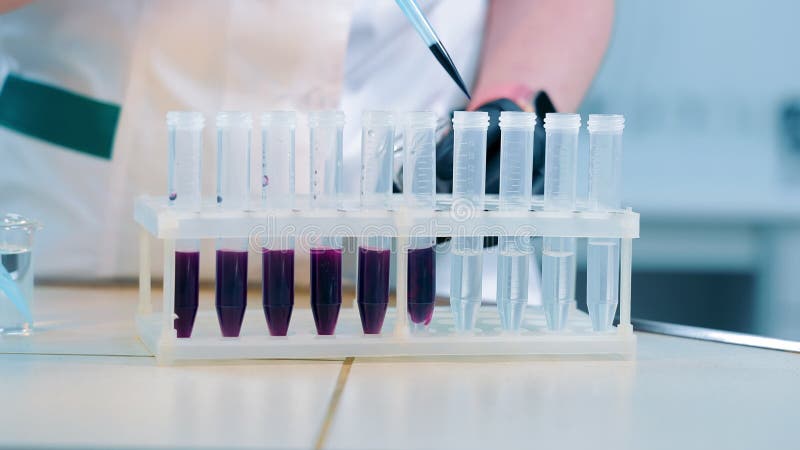 Laboratory Test Tubes with Samples. Lab Test Tubes Filled with Purple ...