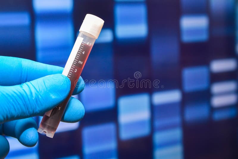 Laboratory Testing of a Biological Sample Stock Image - Image of care ...