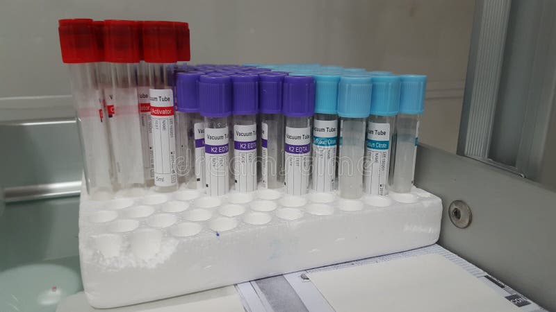 Laboratory Tubes for Blood Test Stock Image - Image of blood, tree ...