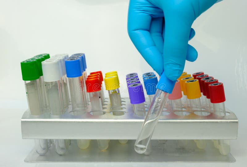 Laboratory tubes stock photo. Image of laboratory, label - 153594244