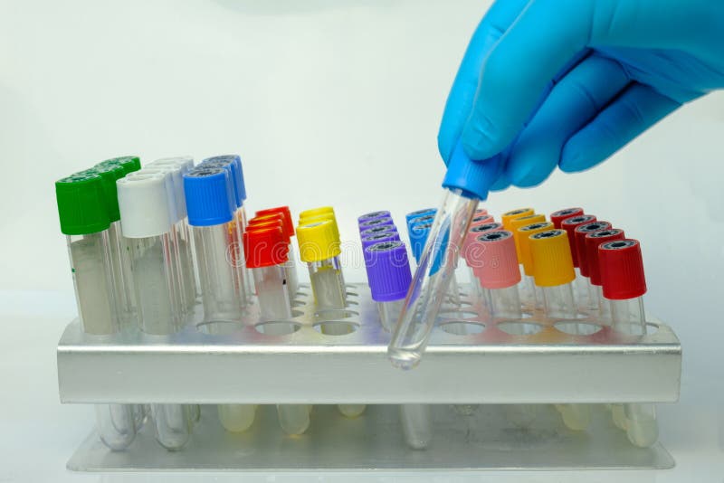 Laboratory Tubes For Experiments Stock Photo - Image of hand, bowl ...