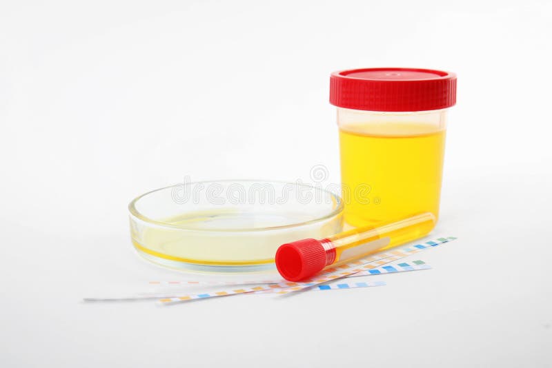 Urine Samples stock image. Image of research, exam, sample - 7591065