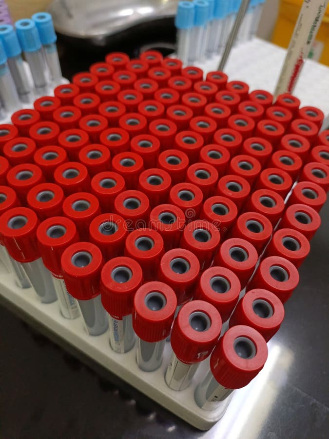 Laboratory Workbench Holding Multiple Flasks and Test Tubes, Arranged ...