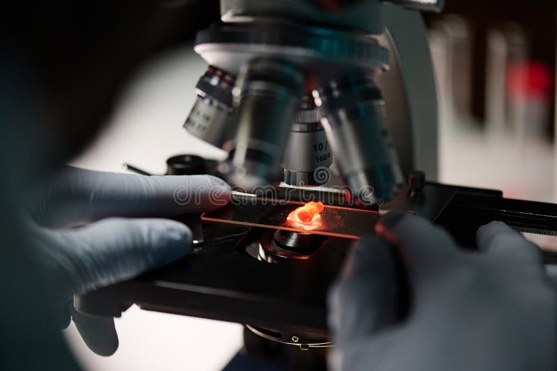 Laboratory Worker Placing Particle of Meat Under Microscope Stock Image ...