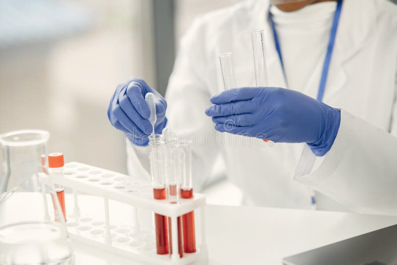 Laboratory Worker Studying Blood Samples To Detect Pathologies Stock ...