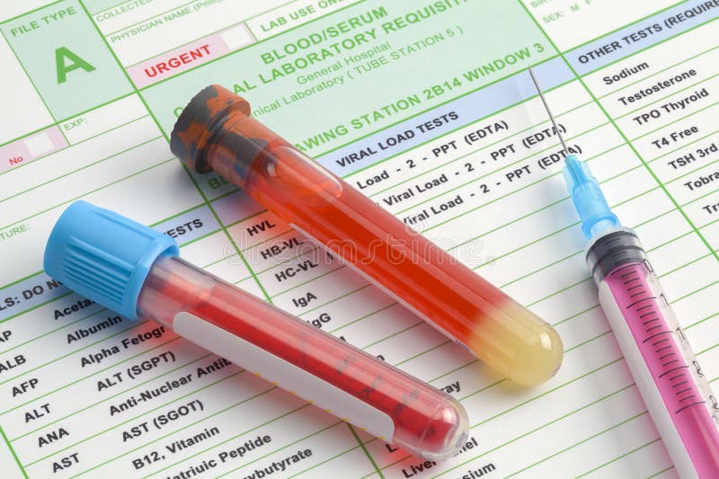 Labs Blood Work stock image. Image of exam, form, liquid - 69003607