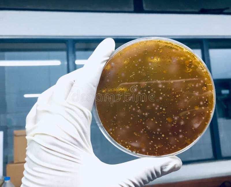 Lactobacillus.spp on MRS Medium Stock Photo - Image of food ...