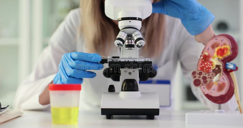 Lady Examines Urine Using Microscope To Check Kidney Stock Video ...