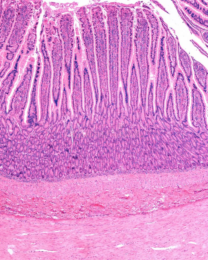 Dunne Darm Intestinale Villi Stock Foto - Image of weefsel, epitheel ...