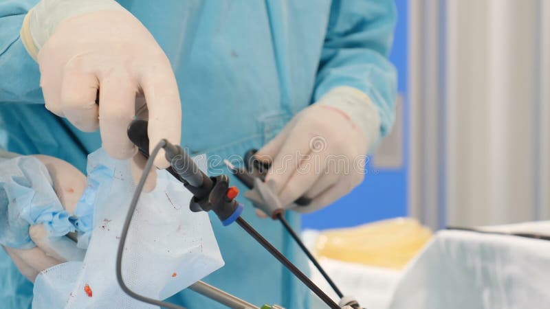 Laparoscopic Cholecystectomy Instrument. Real Surgery, Abdominal ...