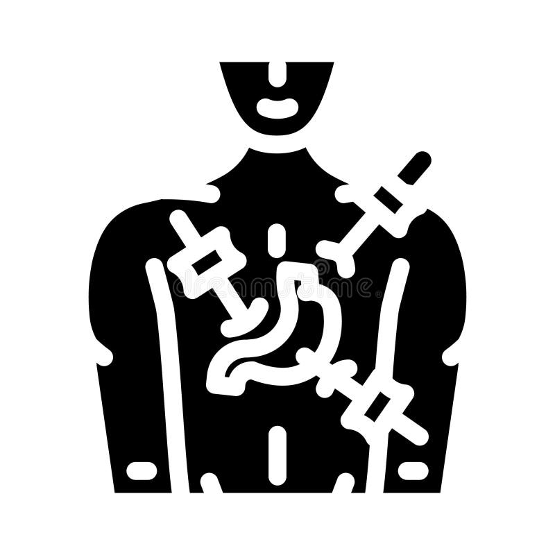Laparoscopy Surgery Glyph Icon Vector Illustration Stock Vector ...