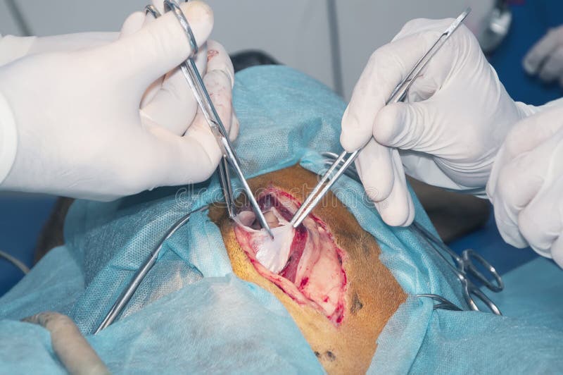 Laparotomy the Process of Peritoneal Incision Concept of Surgery Stock ...