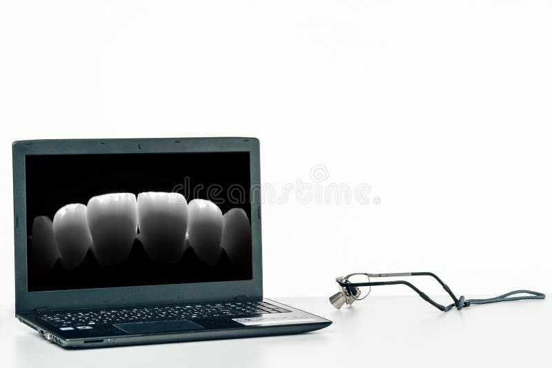 Laptop and Dental Tools on a White Table Stock Photo - Image of table ...