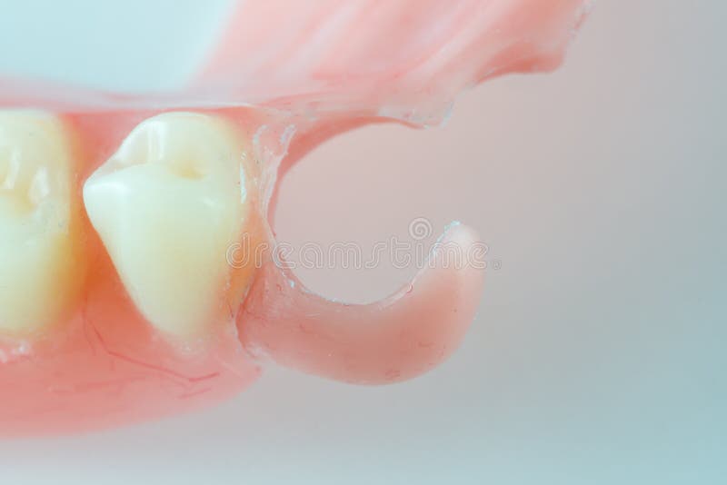 Image of a Modern Denture on a White Background Stock Photo - Image of ...