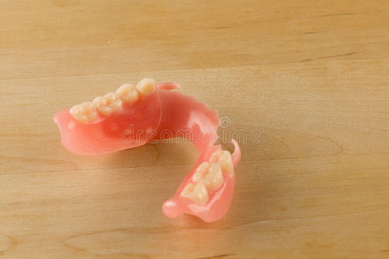 Large Image of a Modern Denture Stock Image - Image of bugel, partial ...