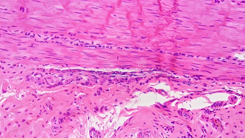 Large Intestinal in Transversal Section Filmed Under Microscope 200x ...