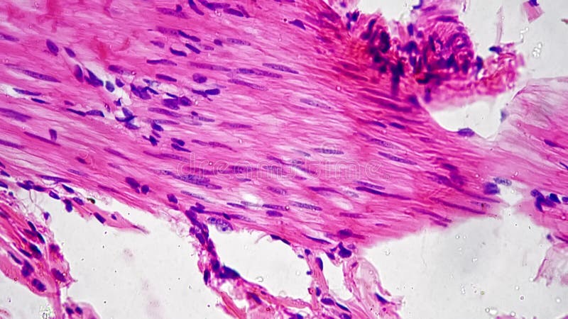 Human Large Intestine in Section Magnified Under Microscope in 200 ...