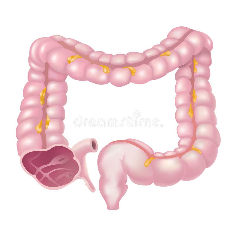 The Large Intestine, Also Called the Colon, is Part of the Final Stock ...