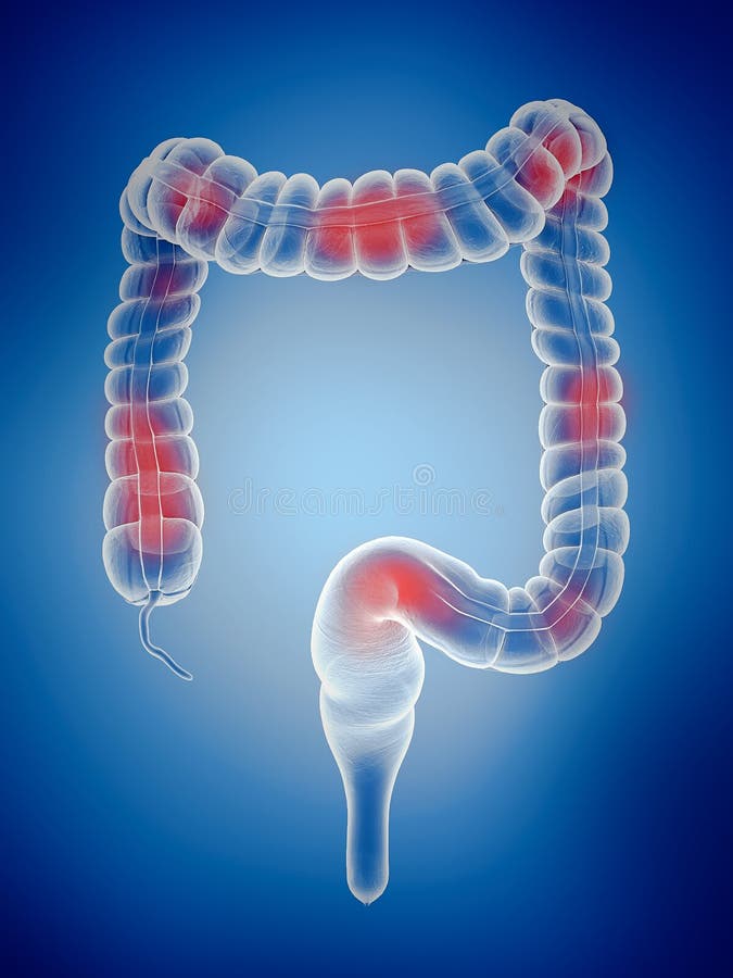 The large intestine stock illustration. Illustration of graphic - 74888491