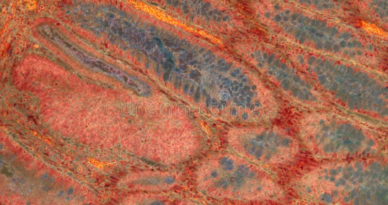 Large Intestine of Human Being in Section Magnified Under Microscope in ...